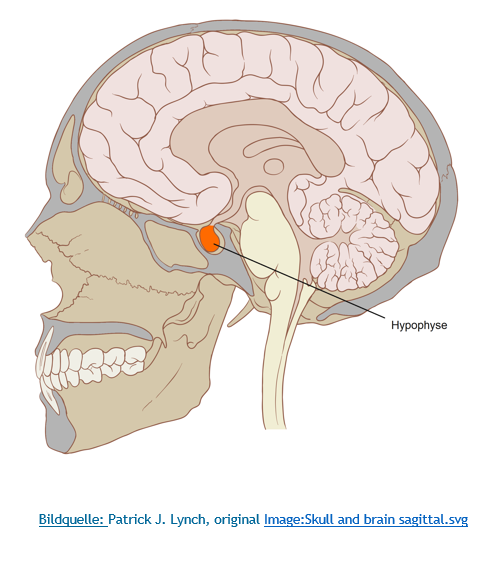 Hypophysentumor - Hirntumor-Zentrum
